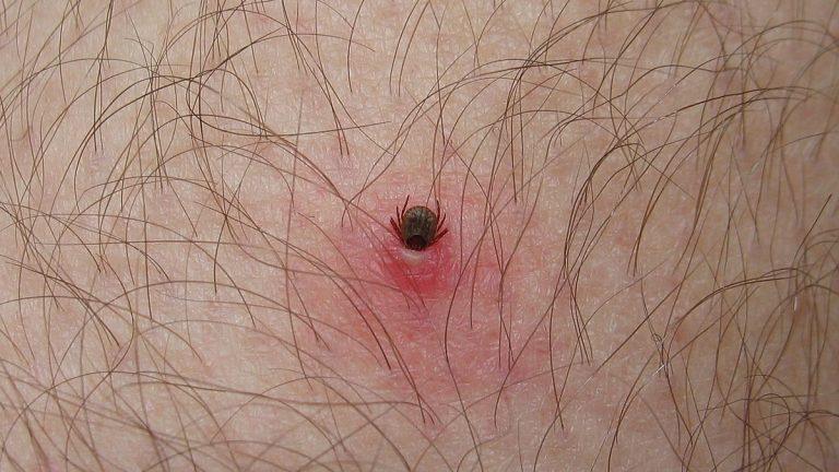What Are Ticks? Identification, Diseases and Prevention