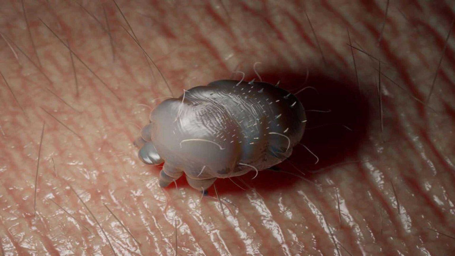 Mites: Types, Infestation, Identification & Prevention Tips