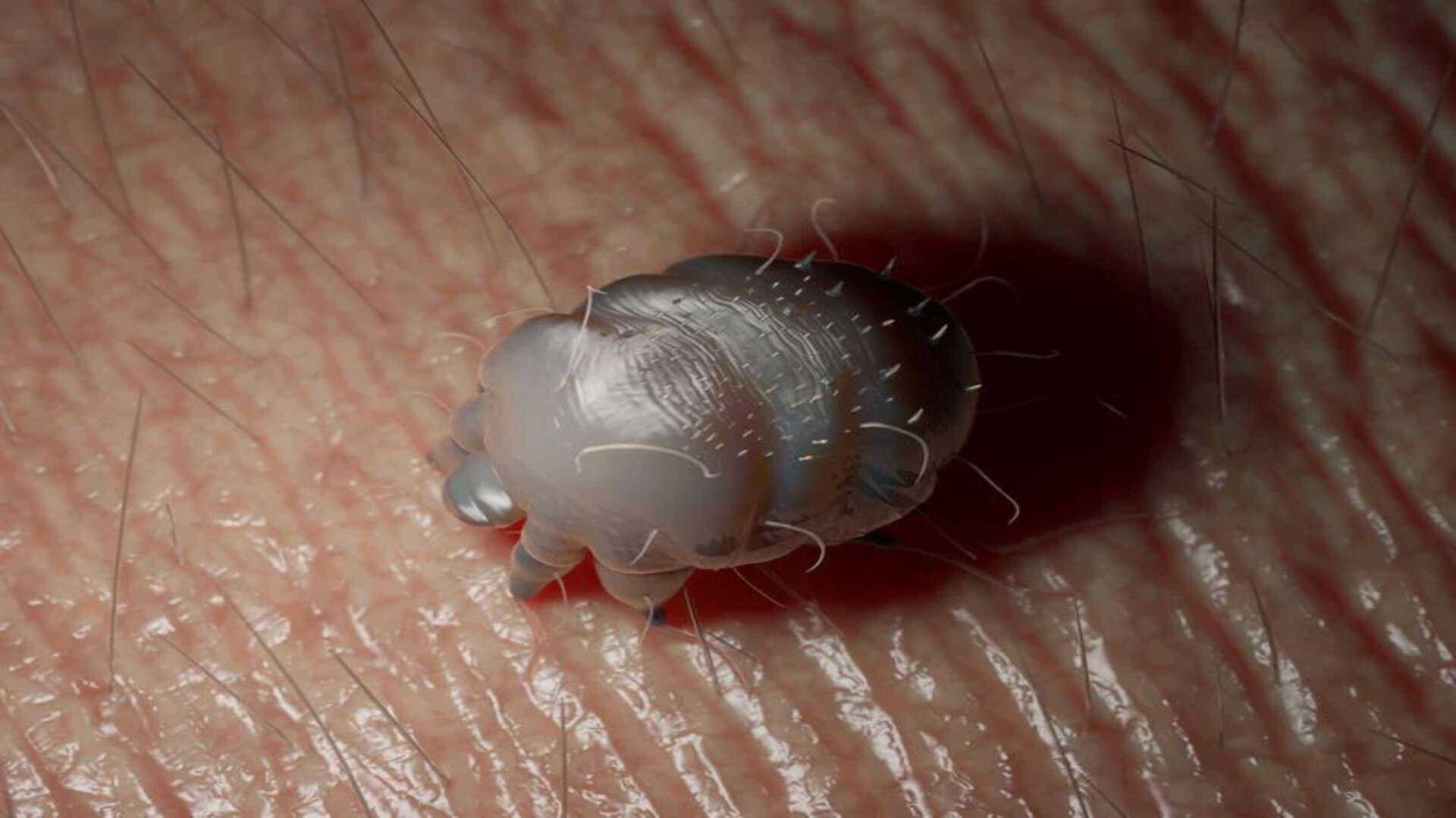 Mites: Types, Infestation, Identification & Prevention Tips