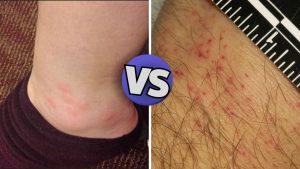 Do Carpet Beetles Bite? You Need to Know | Home Pest Control